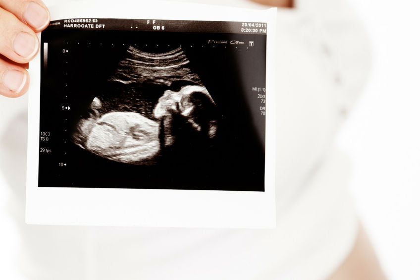 Baby Scans, Ultrasound Scans, Gender Scans, 3D & 4D Scans.. Oh My!